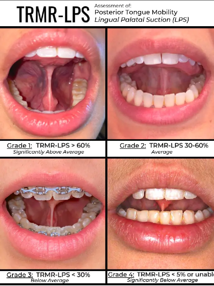 How Flexible Is Your Tongue? Measure Your Mobility | Northstar Lip ...